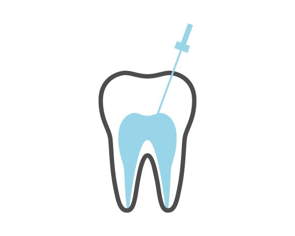 680 Root Canal Illustrations Royalty Free Vector Graphics And Clip Clip Art Library